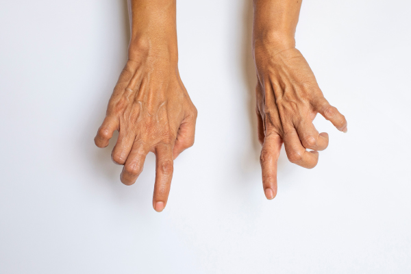 Learn About Conditions - Page 2 - WristSupports.co.uk