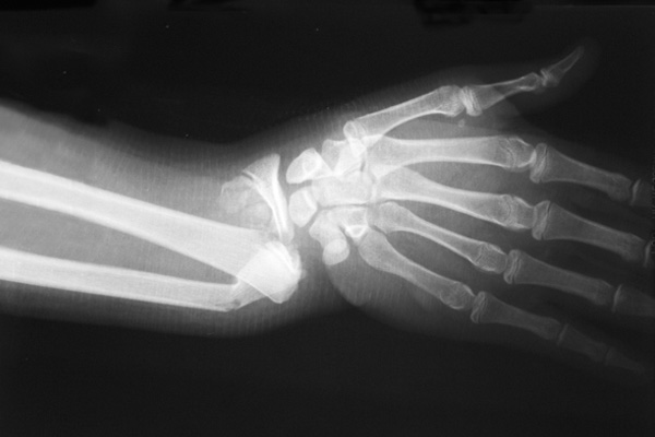 Learn About Conditions - Page 4 - WristSupports.co.uk