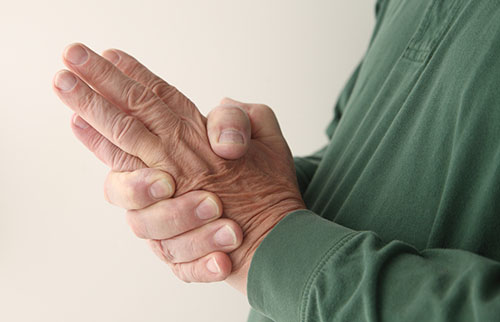 What is Ulnar Deviation? - WristSupports.co.uk